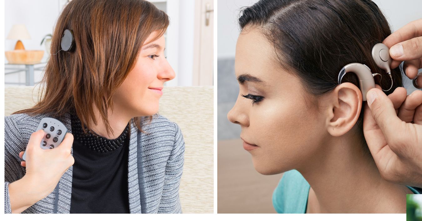 Cochlear Implants for Adults and Children: What You Need to Know ...
